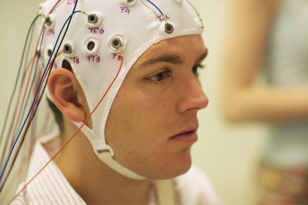 مزایا و عوارض Tdcs چیست؟ آیا تحریک الکتریکی مغز عوارض دارد؟ دکتر